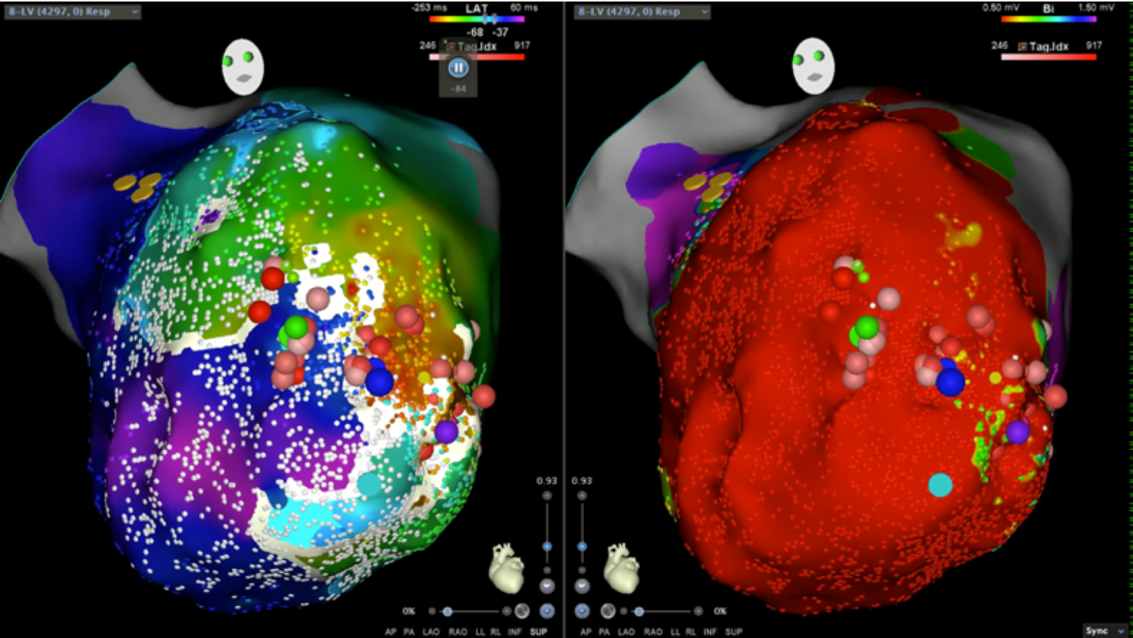 Westmead Hospital Foundation : Heart Engineering Team
